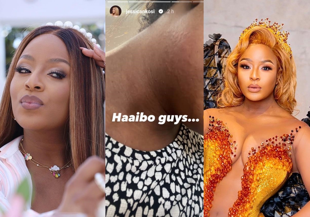 In pictures: Former The Queen actress Jessica Nkosi 'Thando' attacked by a rare skin disease